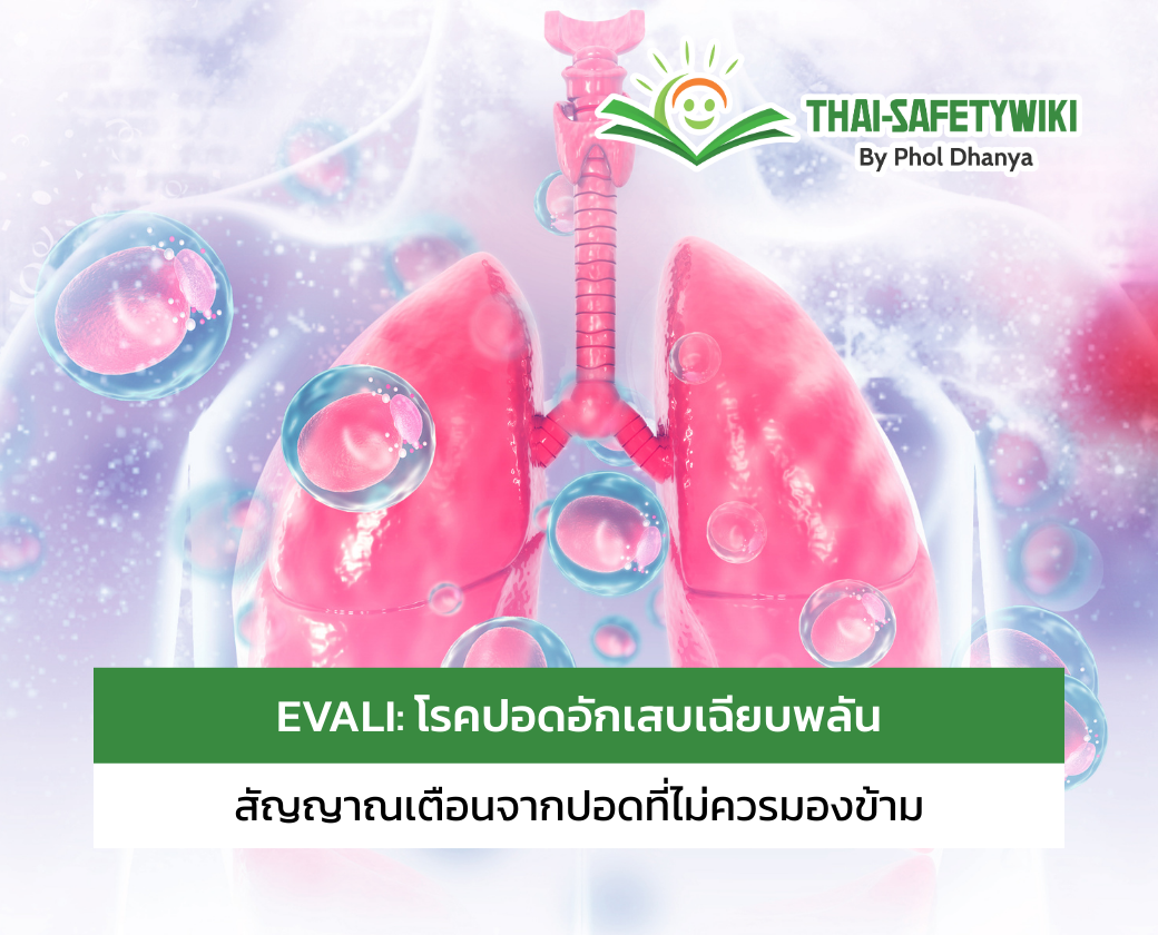 EVALI:โรคปอดอักเสบเฉียบพลัน สัญญาณเตือนจากปอดที่ไม่ควรมองข้าม - Thai ...